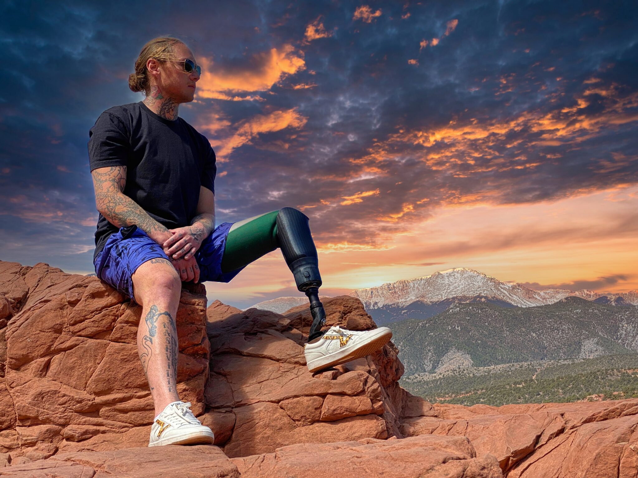 BioWorld: Xtremity steps out with $8.1M fundraising round for its adjustable prosthetic socket ...